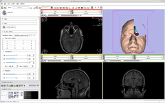 AHM 2010 Tutorial Contest - Port of Slicer to Qt - NAMIC Wiki