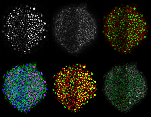 ITK GPAC level set - NAMIC Wiki