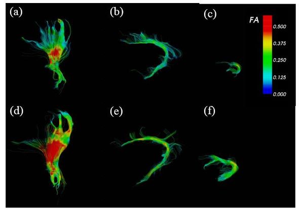 Projects:DTIModeling - NAMIC Wiki