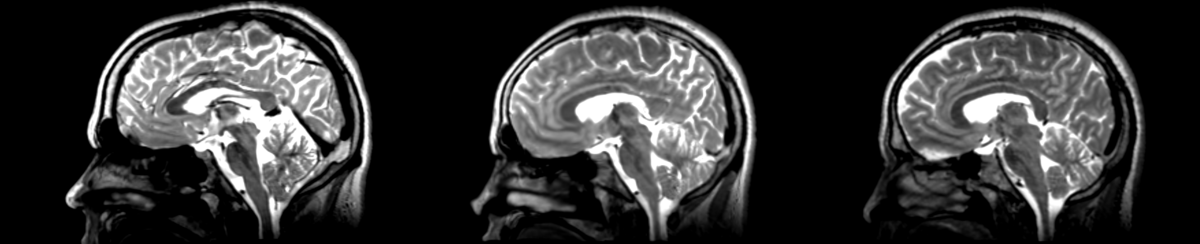 Projects:DBP2:Harvard:Registration Documentation - NAMIC Wiki