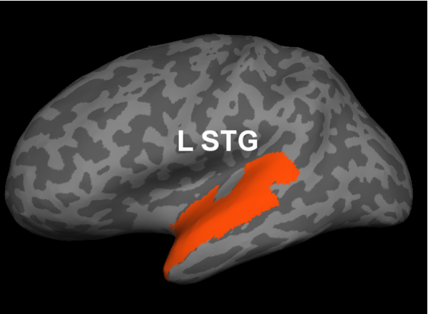 Projects:GenerativeBrainConnectivity - NAMIC Wiki