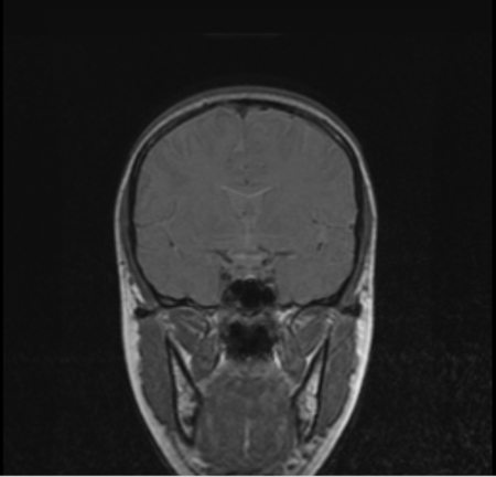BRAINSMush - NAMIC Wiki