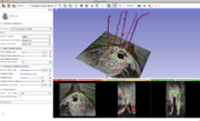 2012 Summer Project Week:Interactive Needle Segmentation - NAMIC Wiki