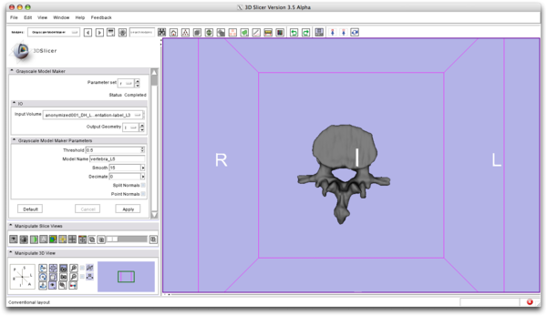 2010 Winter Project Week Spine Segmentation Module in Slicer3 - NAMIC Wiki