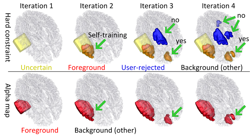 Projects:PathologyAnalysis - NAMIC Wiki