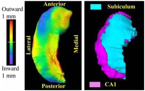 NA-MIC NCBC Collaboration:3D Shape Analysis for Computational Anatomy ...