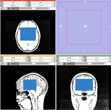 BRAINSMush - NAMIC Wiki