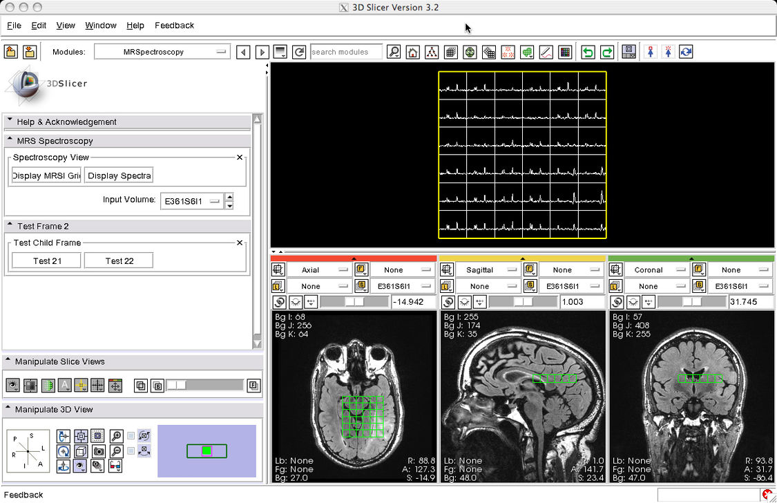 2010 Summer Project Week MRSI module and SIVIC interface - NAMIC Wiki