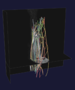 2010 Summer Project Week/The Vascular Modeling Toolkit in 3D Slicer ...
