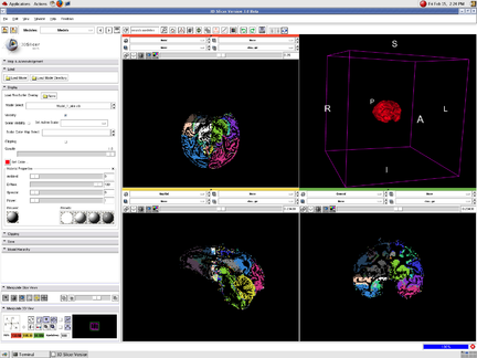 NA-MIC External Collaborations - NAMIC Wiki