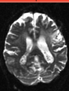 Projects:RegistrationDocumentation:RegLibList - NAMIC Wiki