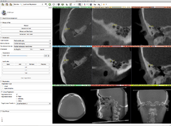 2013 Summer Project Week:Landmark Registration - NAMIC Wiki
