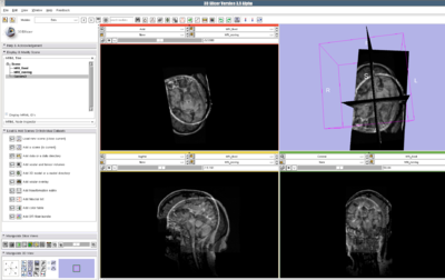 TrainingDataGallery - NAMIC Wiki