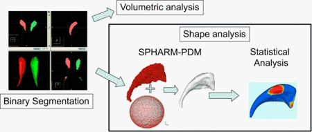 Projects:ShapeAnalysisFrameworkUsingSPHARMPDM - NAMIC Wiki