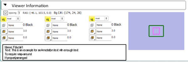Events:Slicer4-Review-07-2011 - NAMIC Wiki