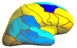 Projects:RegistrationRegularization - NAMIC Wiki