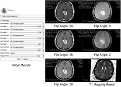 T1 mapping for variable flip angle - NAMIC Wiki