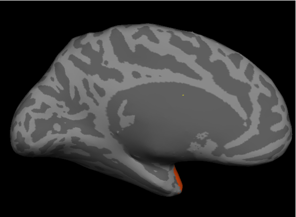 Projects:GenerativeBrainConnectivity - NAMIC Wiki