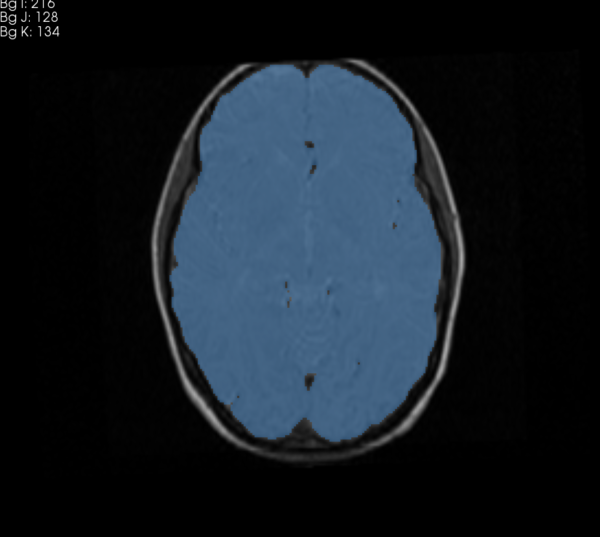 BRAINSMush - NAMIC Wiki