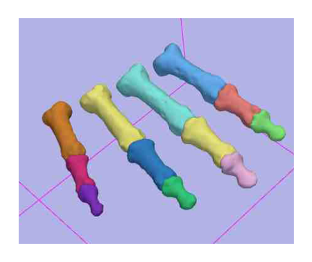 EM Segmentation For Orthopaedic Applications - NAMIC Wiki