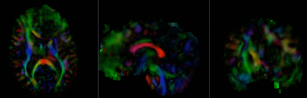 Projects:RegistrationLibrary:RegLib C33 - NAMIC Wiki