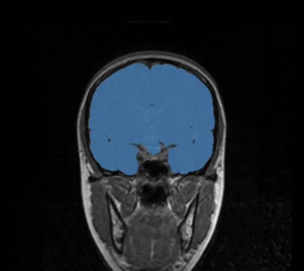 BRAINSMush - NAMIC Wiki
