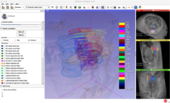 2016 Summer Project Week/Brain atlas combining histology and MRI ...