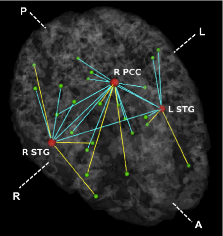 Projects:GenerativeBrainConnectivity - NAMIC Wiki