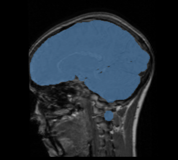 BRAINSMush - NAMIC Wiki